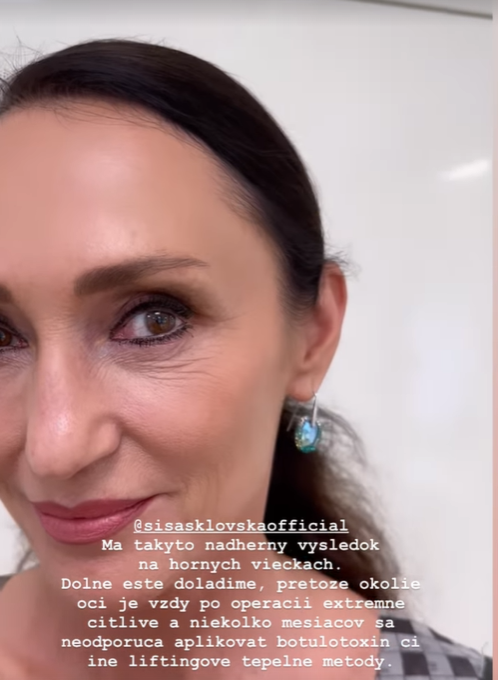 FOTO Sisa Lelkes Sklovska po plastike viečok: POZRITE, ako vyzerá! Musí ... FOTO Sisa Lelkes Sklovska po plastike viečok: POZRITE, ako vyzerá! Musí ...
